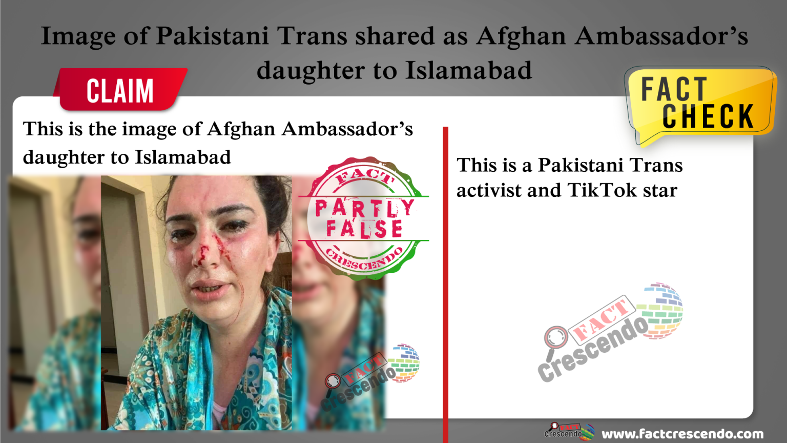 Image of Pakistani Trans shared as Afghan Ambassador’s daughter to ...